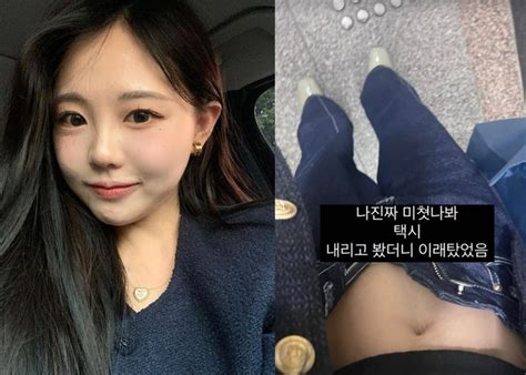 바지 지퍼 열고 속옷 보인 채 택시를 “진짜 미쳤나봐” 홍영기의 ‘아찔 실수 세계일보