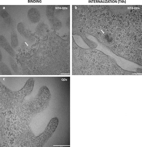Transmission Electron Micrographs Of Ht 29 Cell Line Incubated With