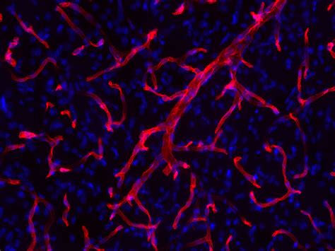 Histosure Collagen Type Iv