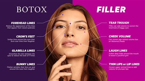 Botox Vs Filler Treatments Venus Aesthetics Anti Aging