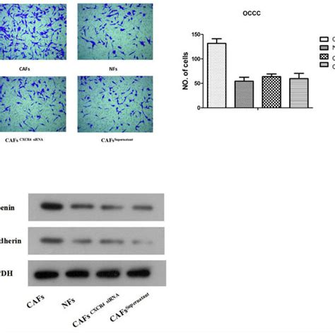 Cxcr4 Enriched Exosome Promotes Invasion Of Es2 Cells A A Transwell
