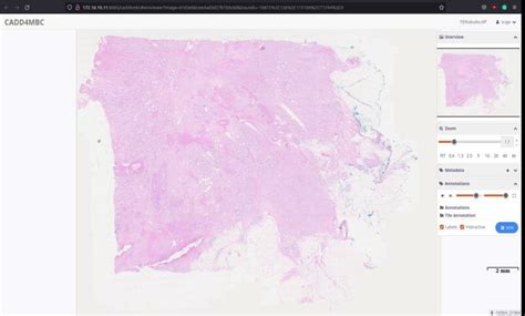 Visualization Of A Wsi Download Scientific Diagram