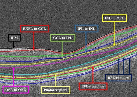 Definition Of Retinal Surfaces From Inner Retina To Its Outer Download Scientific Diagram