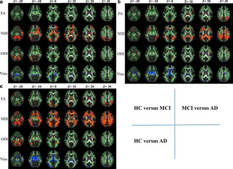 a b and c are the results of comparisons between hc and mci mci and