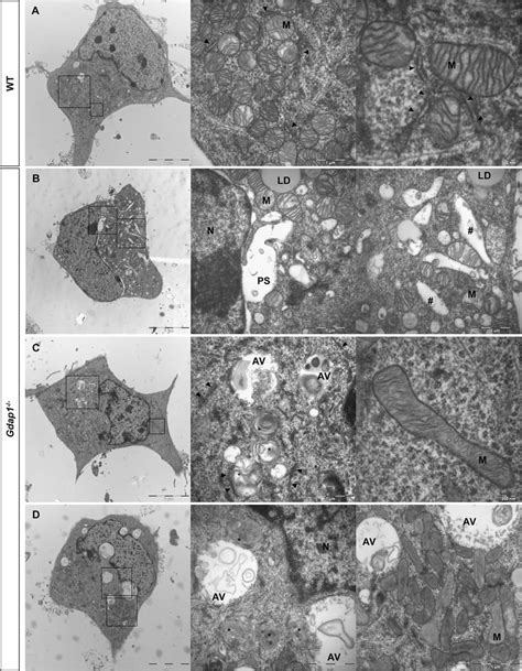 Ultrastructural Analysis Of Embryonic Motor Neurons Wt A And