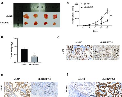 Ube2t Knockdown Suppressed Tumor Growth In Vivo A Photograph Of