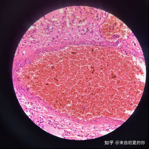 病理学切片图 知乎
