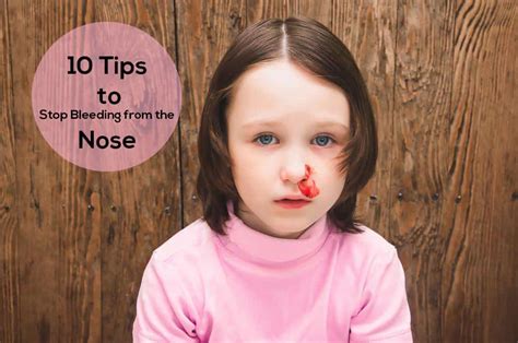 10 Tips To Stop Bleeding From The Nose WikiJunkie