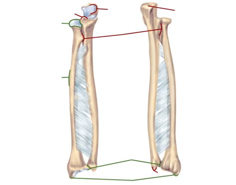Radius And Ulna Bone Markings Quiz