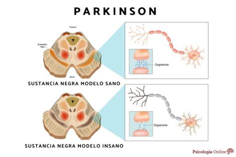 Striatum Structure Functions And Associated Disorders 2025
