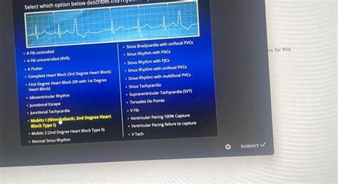 Solved Select Which Option Below Describes A Fib Chegg