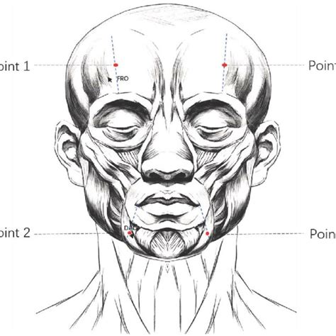 Abbreviations Pfp Peripheral Facial Paralysis Fema Facial Expression