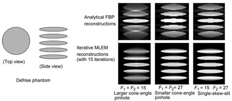 Defrise Phantom And Its Reconstructions With Analytical And Iterative