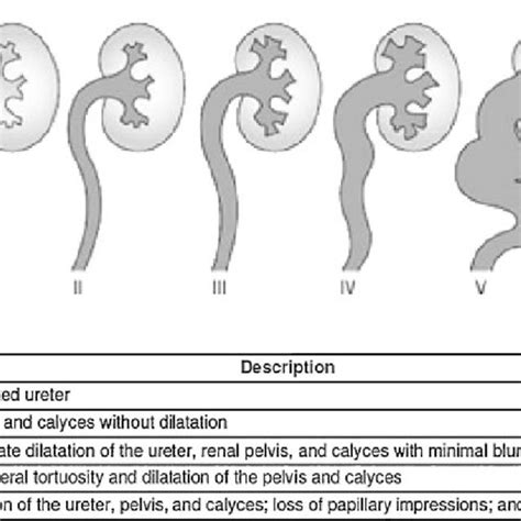 International Classification Of Vesicoureteral Reflux 11 Used With
