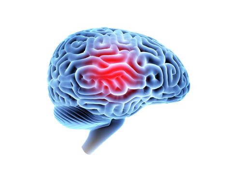 Traumatic Brain Injury Services Jamaica Hospital Medical Center