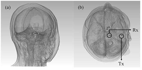 Mida Model And Dipole Antennas A Side View B Front View Download Scientific Diagram