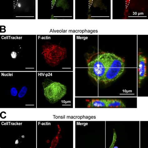 Hiv 1 Induced Heterotypic Cell Fusion With Infected Jurkat T Cells Is