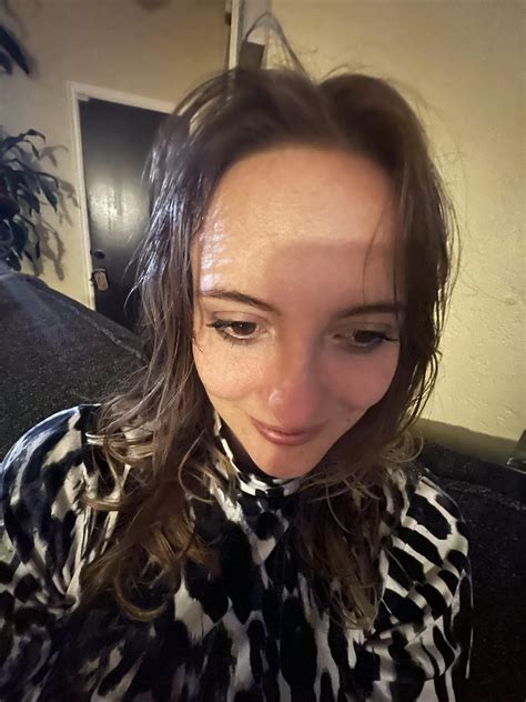 Heres My Results…been Mewing For 4 Years And I Got My Broken Nose Fixed So That I Could Breathe