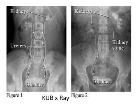 Introduction To Abdominal Radiography Flashcards Quizlet