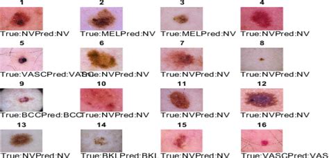 Predictions On Random Samples Made By Transfer Learning On Mobilenetv