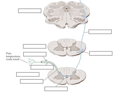 Anterolateral Pathway Pt 2 Quiz
