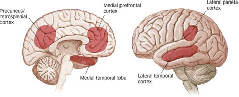 Mesial Temporal Lobe Anatomy