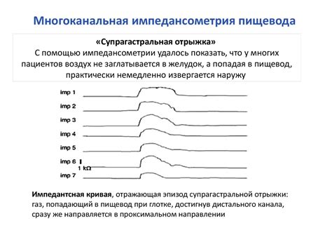 Функциональная гастроэнтерология - презентация онлайн