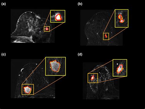Multiparametric Deep Learning Tissue Signatures For A Radiological