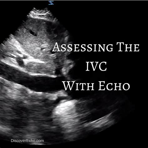 Ultrasound Couinauds Liver Segments 54 Off