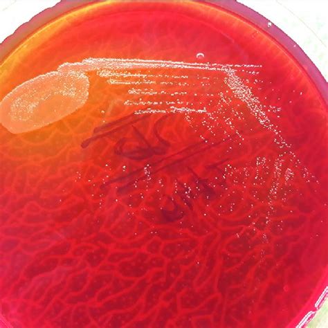 Comamonas Testosteroni Infections In The Medical Literature Download