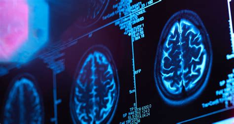 Neuroscience Bs Find Your Degree