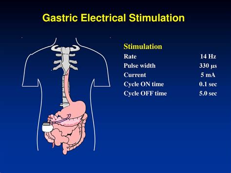 Keck School of Medicine, University of Southern California - ppt download