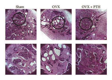Prevention Experiment Reference Measurements Examples Of Bone Marrow Download Scientific