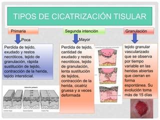 Tema I Reparación Tisular Pptx