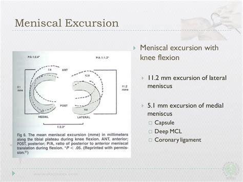 Meniscus Repair Vs Meniscectomy