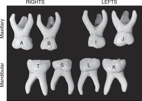 Primary Maxillary Second Molar