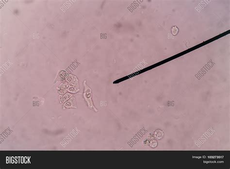 Renal Transitional Epithelial Cells