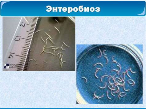 Энтеробиоз у грудничка: симптомы и лечение