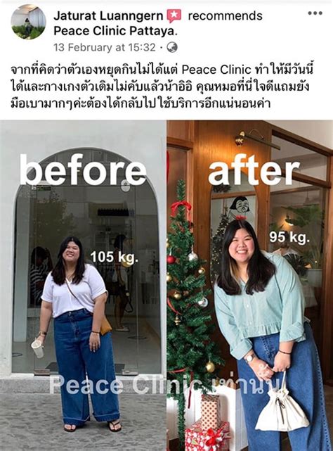 หุ่นดีมีได้ ไม่ต้องอด ด้วยปากกาลดความหิว Peace Clinic ชลบุรี พัทยาเหนือ