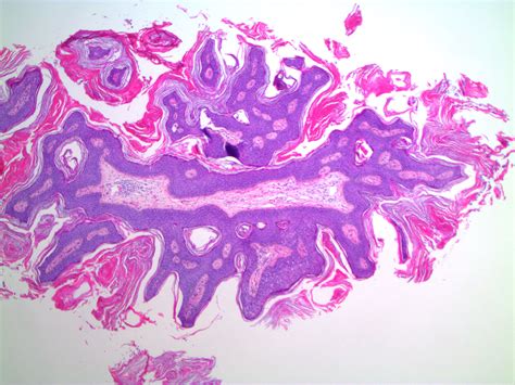 Pathology Outlines Histology