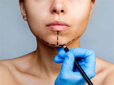 Mini Facelift Sydney Dr Zacharia