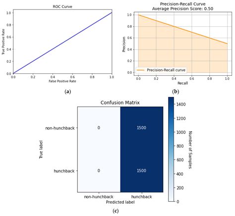 Iot Based Solution For Detecting And Monitoring Upper Crossed Syndrome