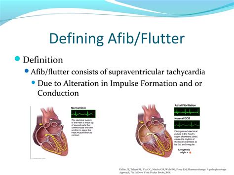 Atrial Fibrillationflutter Presentation Ppt Heart And