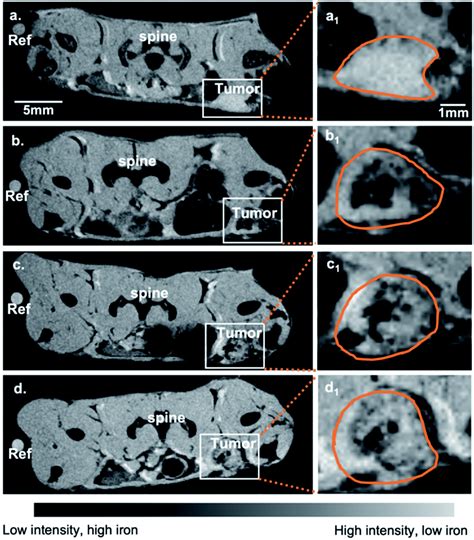 Magnetic Resonance Imaging Of Tumor Associated Macrophages Tams With A Nanoparticle Contrast