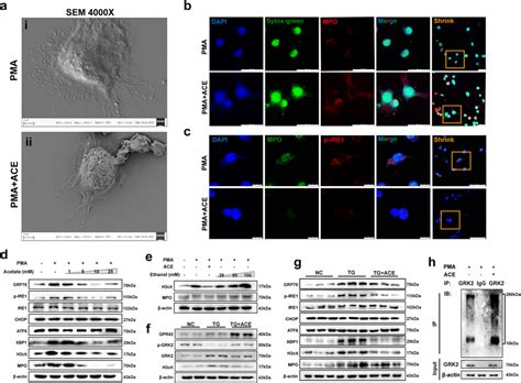 Acetate Reduces Ers In Neutrophils And Inhibits The Formation Of Nets A Download Scientific
