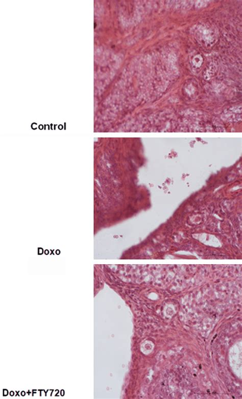 Primordial Follicles Of The Control Upper Panel Doxorubicin Doxo