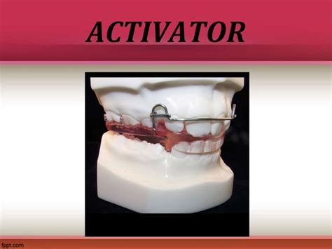 Treatment Of Class Ii Malocclusions Ppt