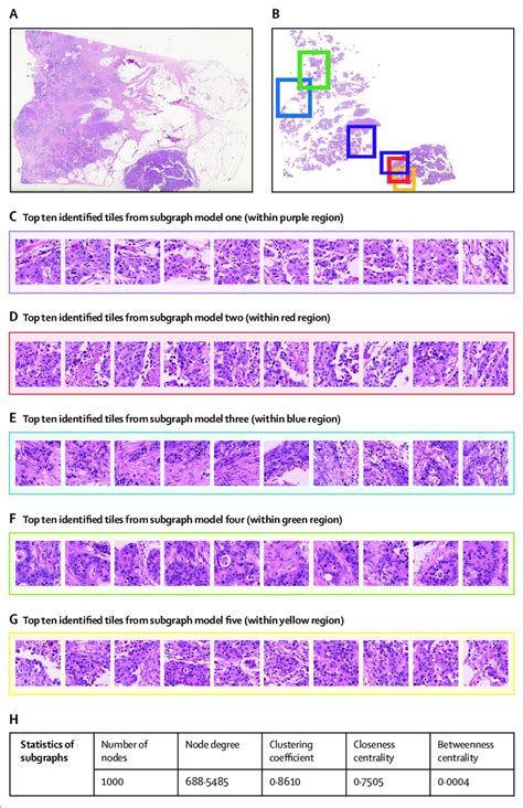 Tp53 Mutation Prediction On Tcga Coad A Original Whole Slide Imaging