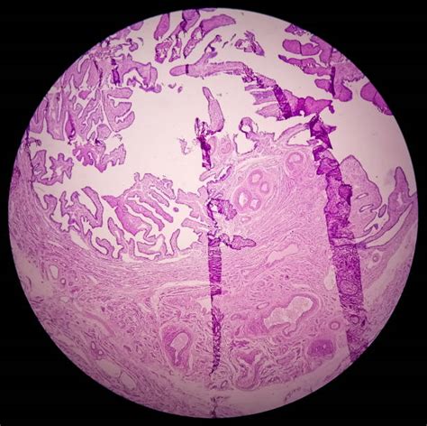 Более 60 работ на тему Teratoma стоковые фото картинки и