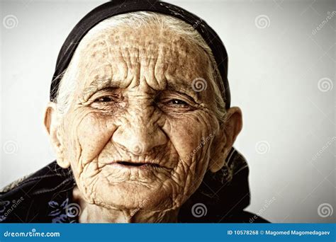 Woman Wrinkles Face Swollen Removal Before Treatment Difference Sagging